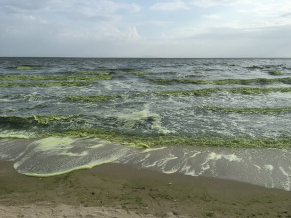 Understanding the Microbial Loop